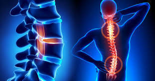 Spine Hygiene - the biggest bang for your buck! - Lyndhurst ...